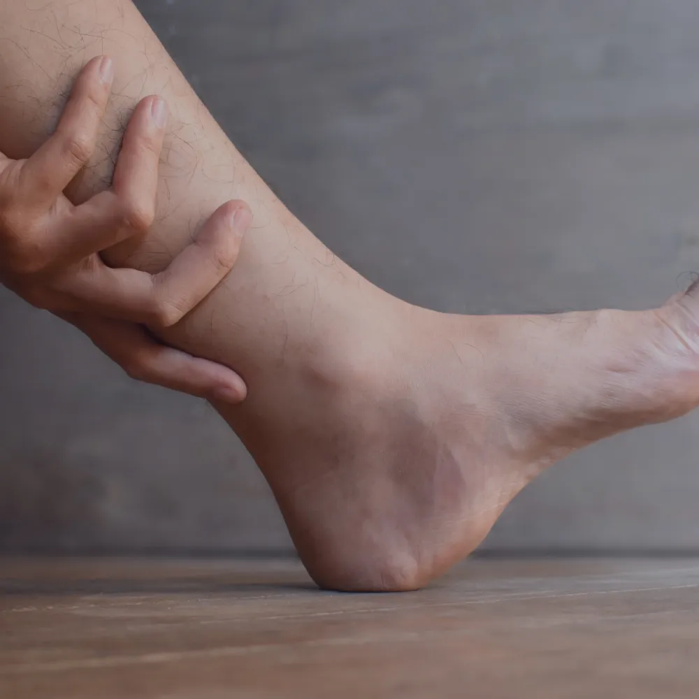 Achilles Tendon Rupture