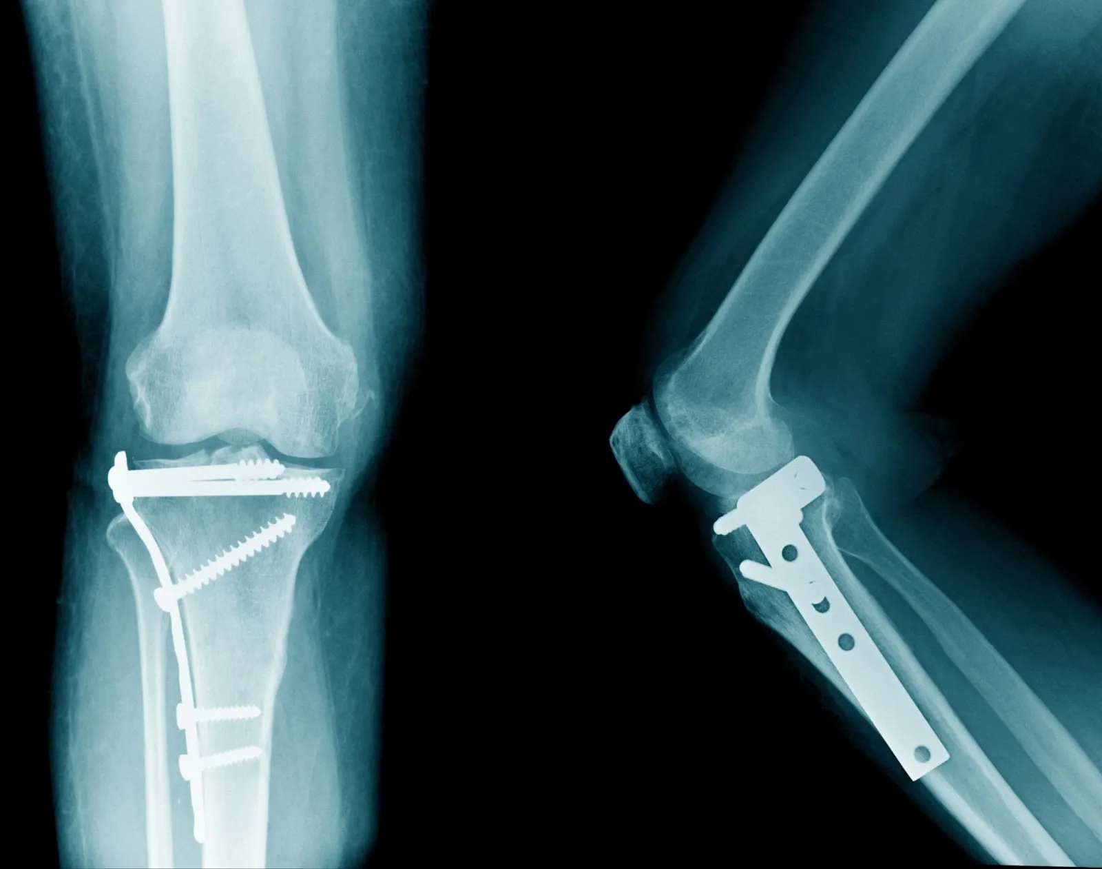 Artisan Orthopaedic