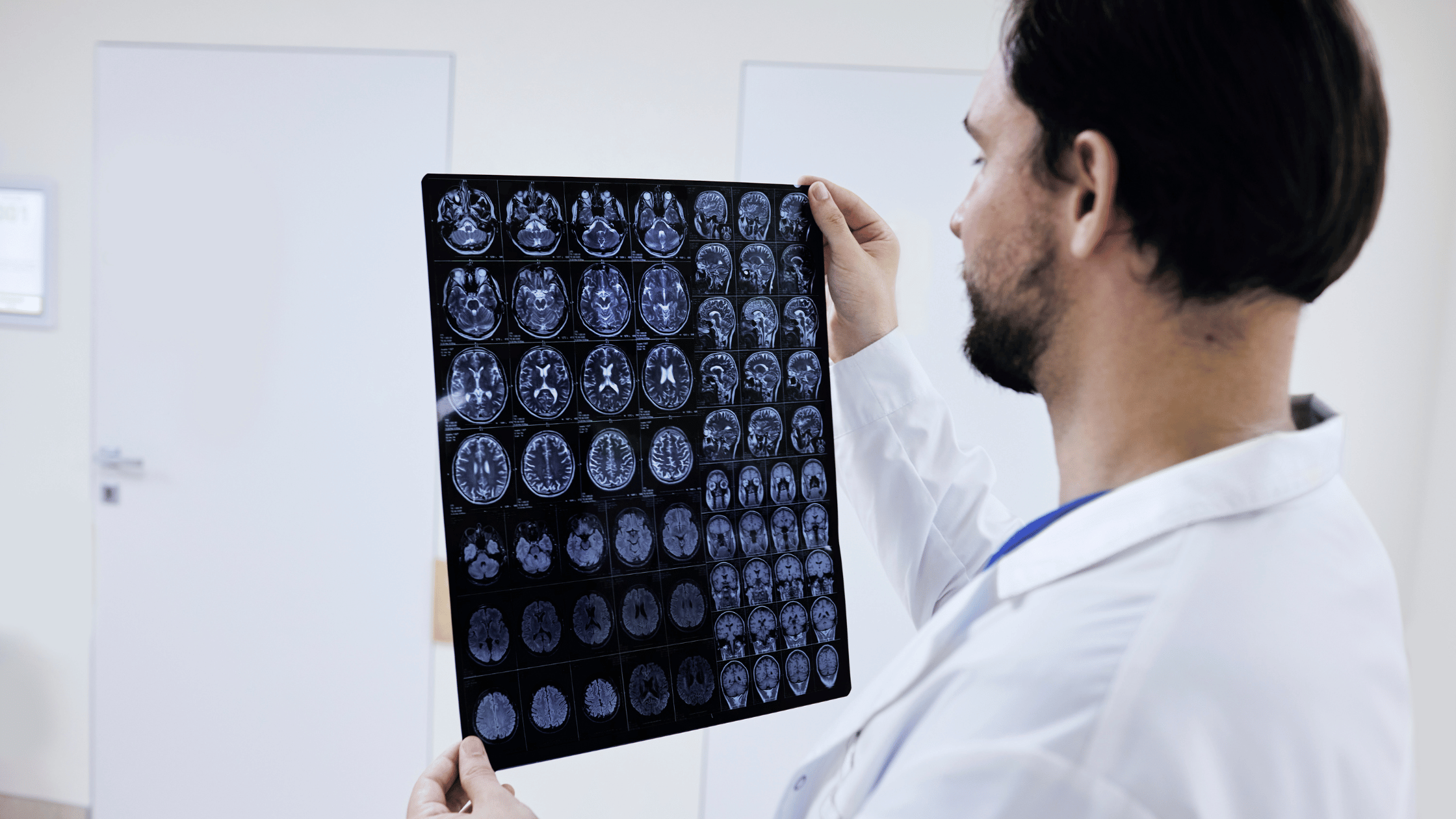 Understanding Seizures: Causes, Types, and Treatment for Effective Care ...