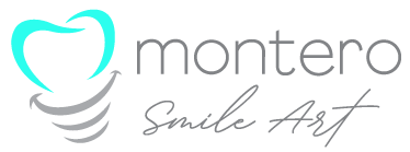 Montero Smile Art | Dental Clinic | Dental Implants Experts