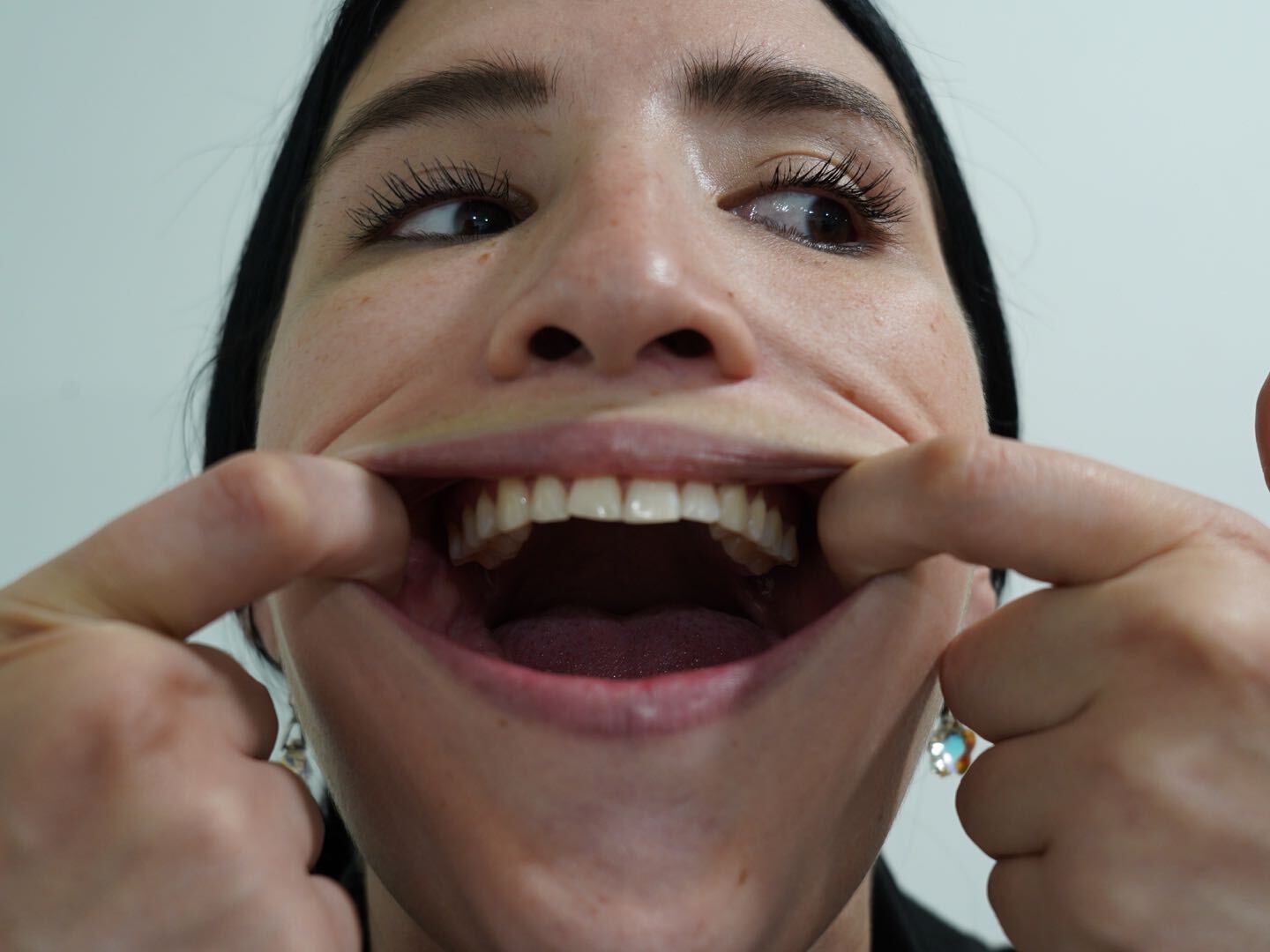 Free Quotation - Montero Smile Art - Dental Clinic