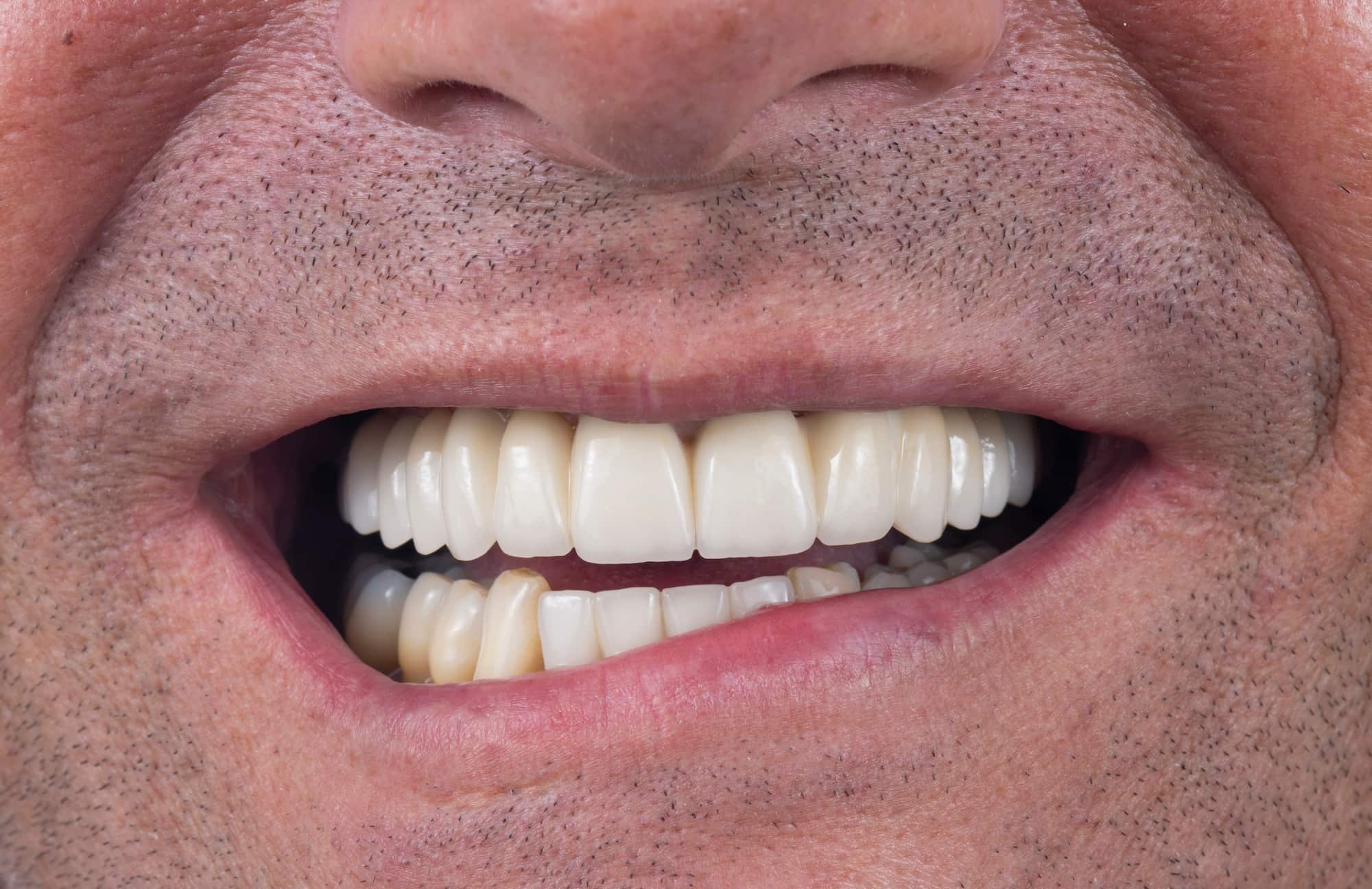 All on Four - Montero Smile Art