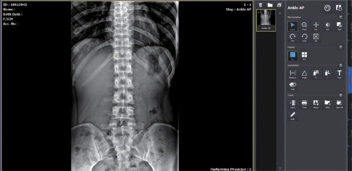 The Chiro Solution