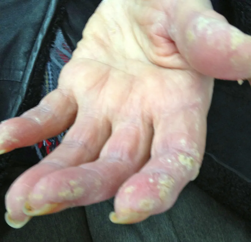 Health Problems Photo Gallery | The Burghwood Clinic