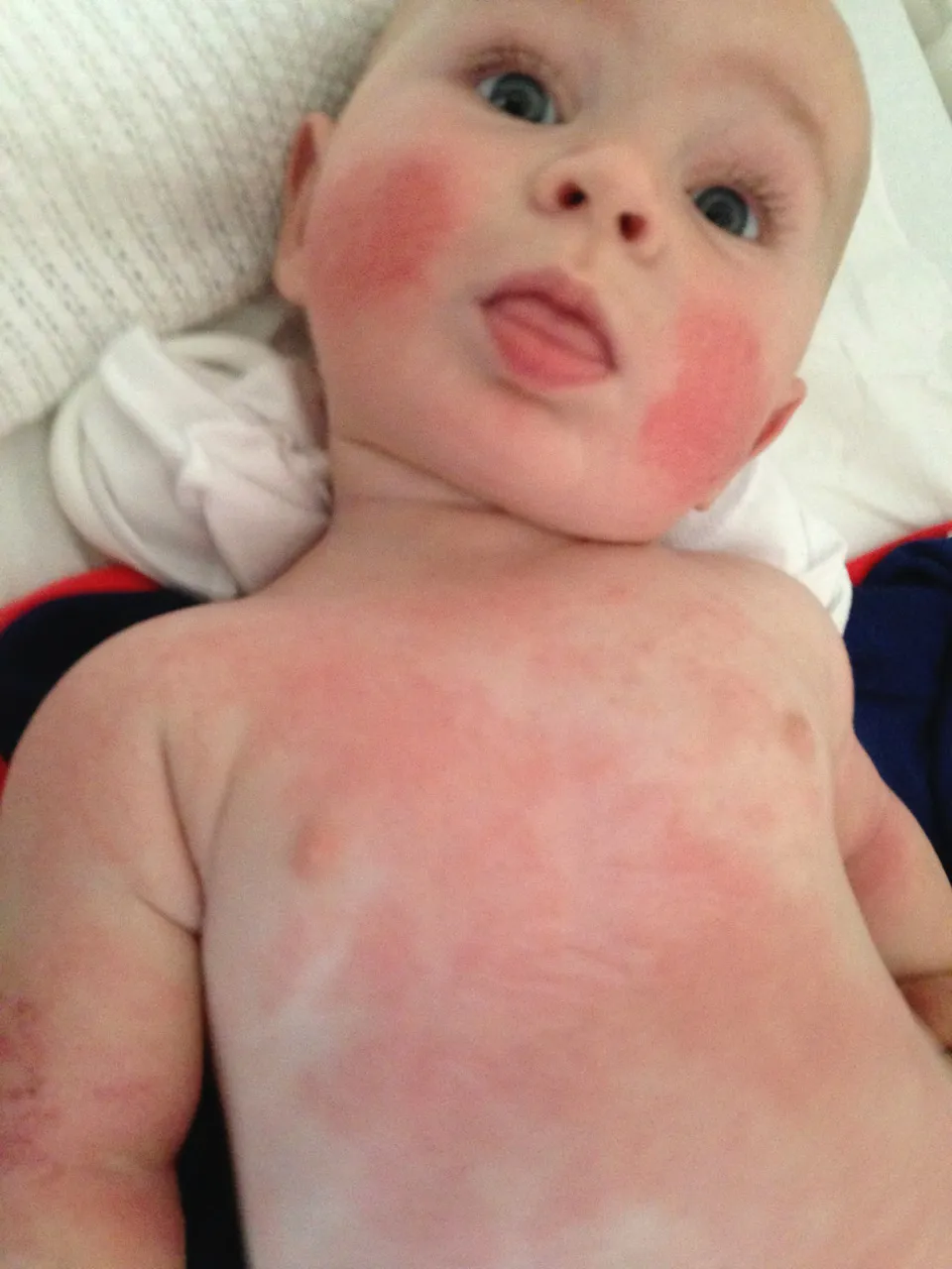 Health Problems Photo Gallery | The Burghwood Clinic