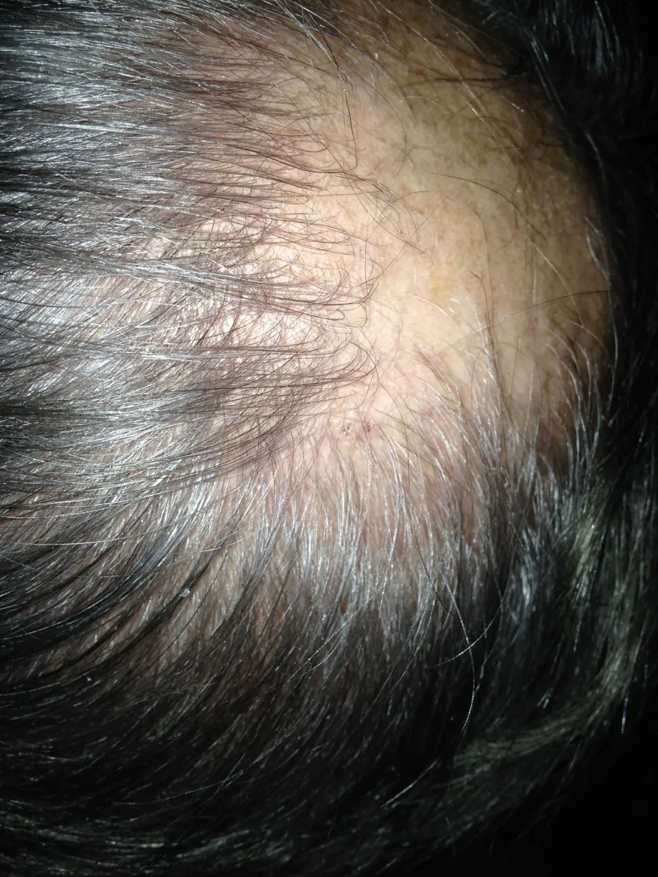 Health Problems Photo Gallery | The Burghwood Clinic