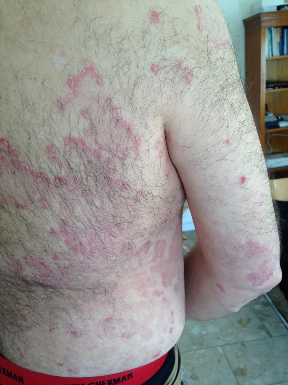 Health Problems Photo Gallery | The Burghwood Clinic