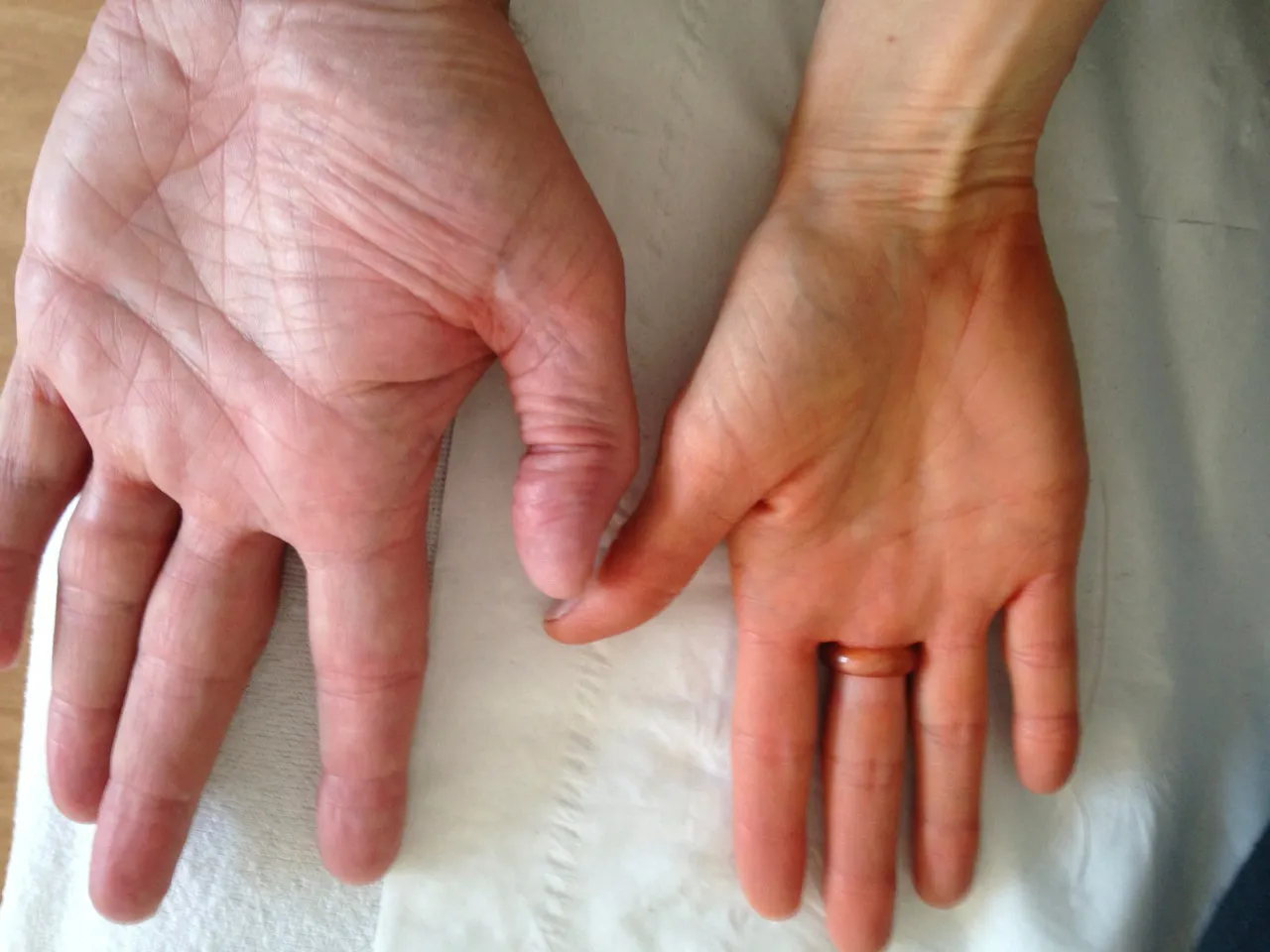Health Problems Photo Gallery | The Burghwood Clinic