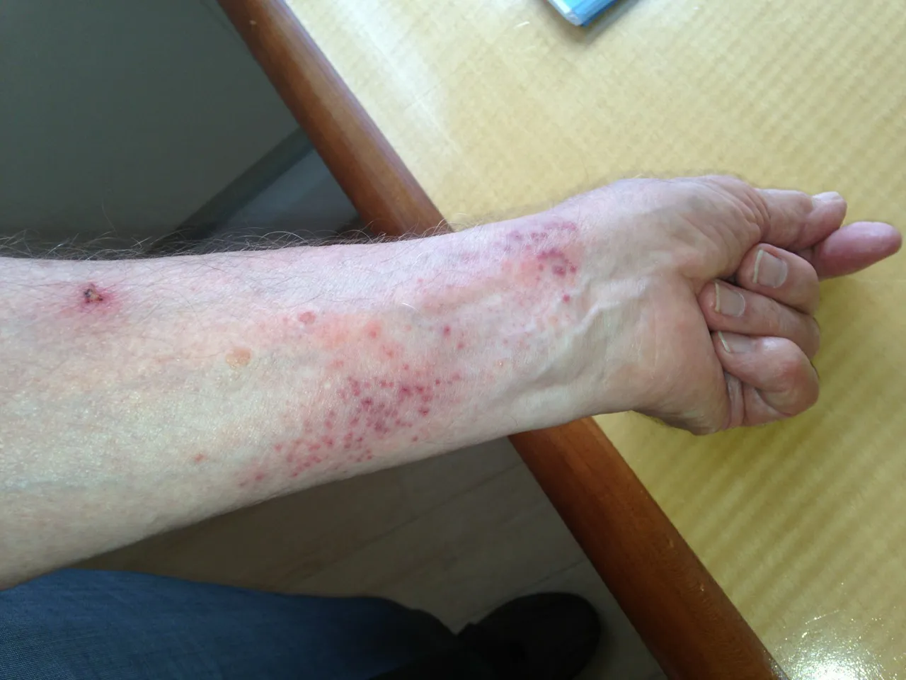 Health Problems Photo Gallery | The Burghwood Clinic