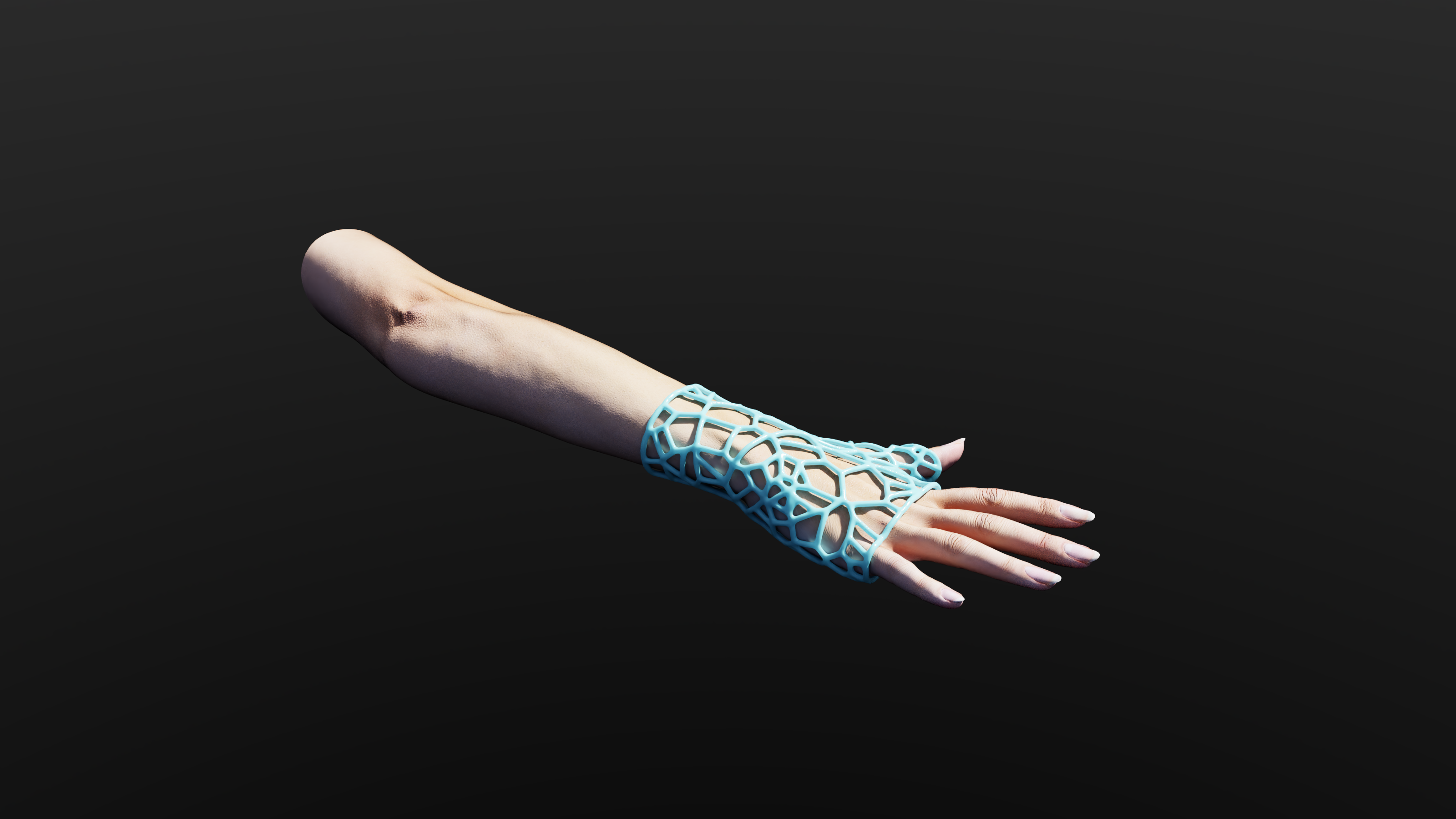 Mass Customized Arm Brace