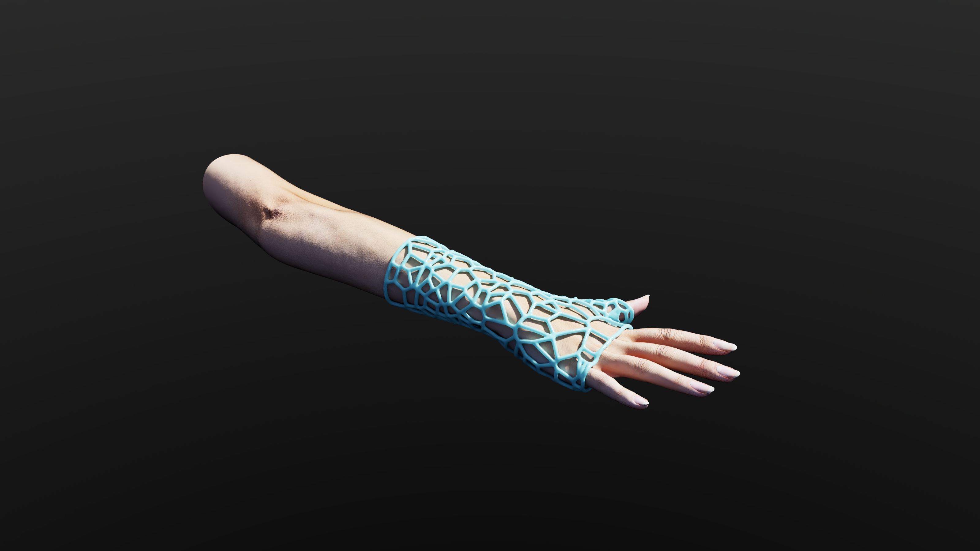 Mass Customized Arm Brace