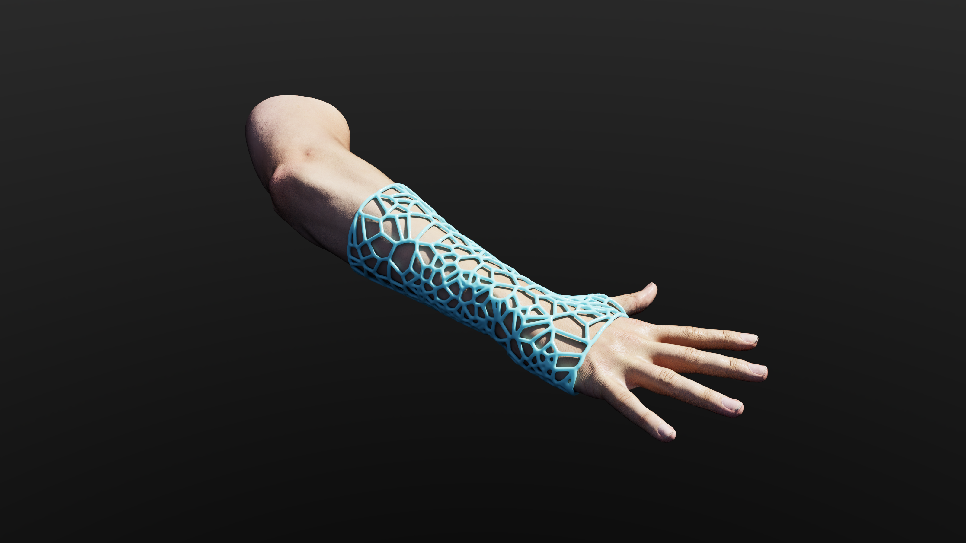 Mass Customized Arm Brace