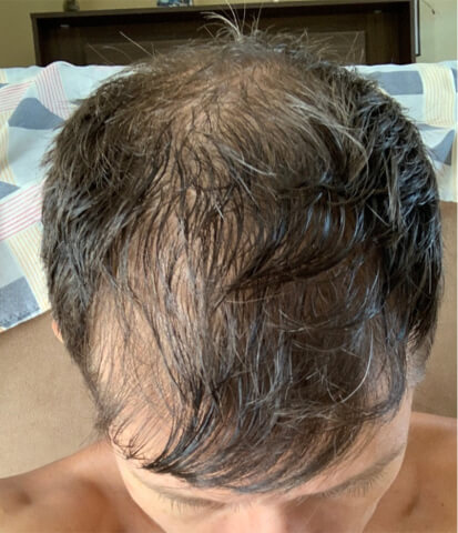 BR: Join Manual "Refresh"