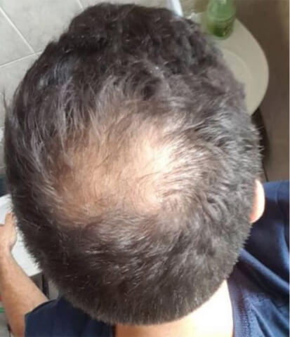 BR: Join Manual "Refresh"