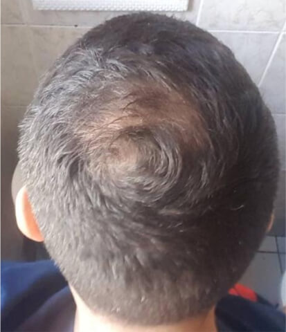 BR: Join Manual "Refresh"