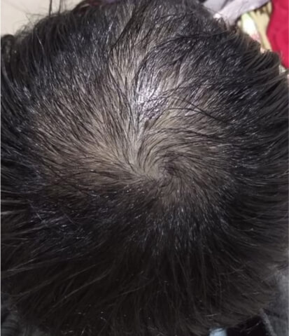 BR: Join Manual "Refresh"