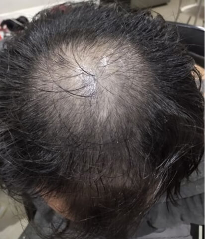 BR: Join Manual "Refresh"