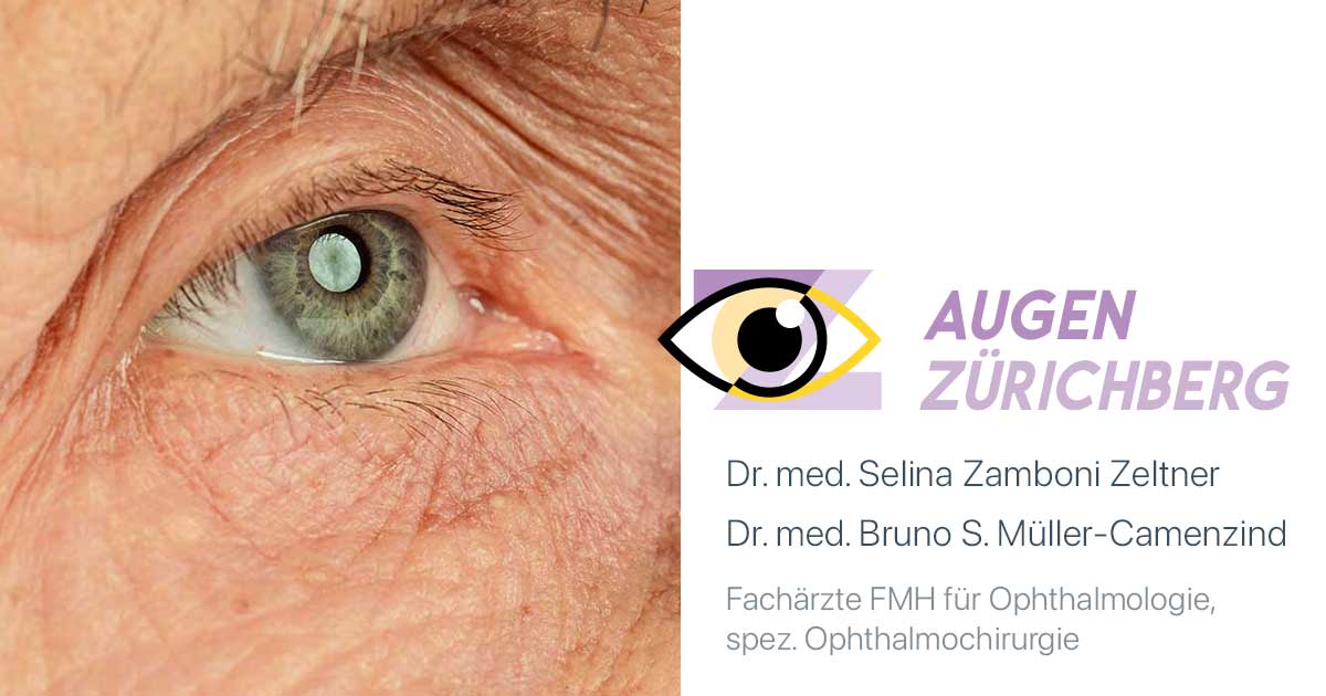 Grüner Star (Glaukom) | Augenarztpraxis Augen Zürichberg | Effektive ...